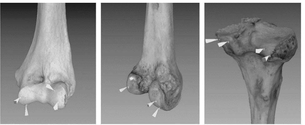 Human Osteoarchaeology